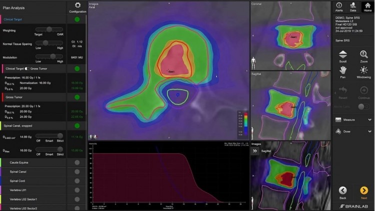 Promedis - Brainlab Elements